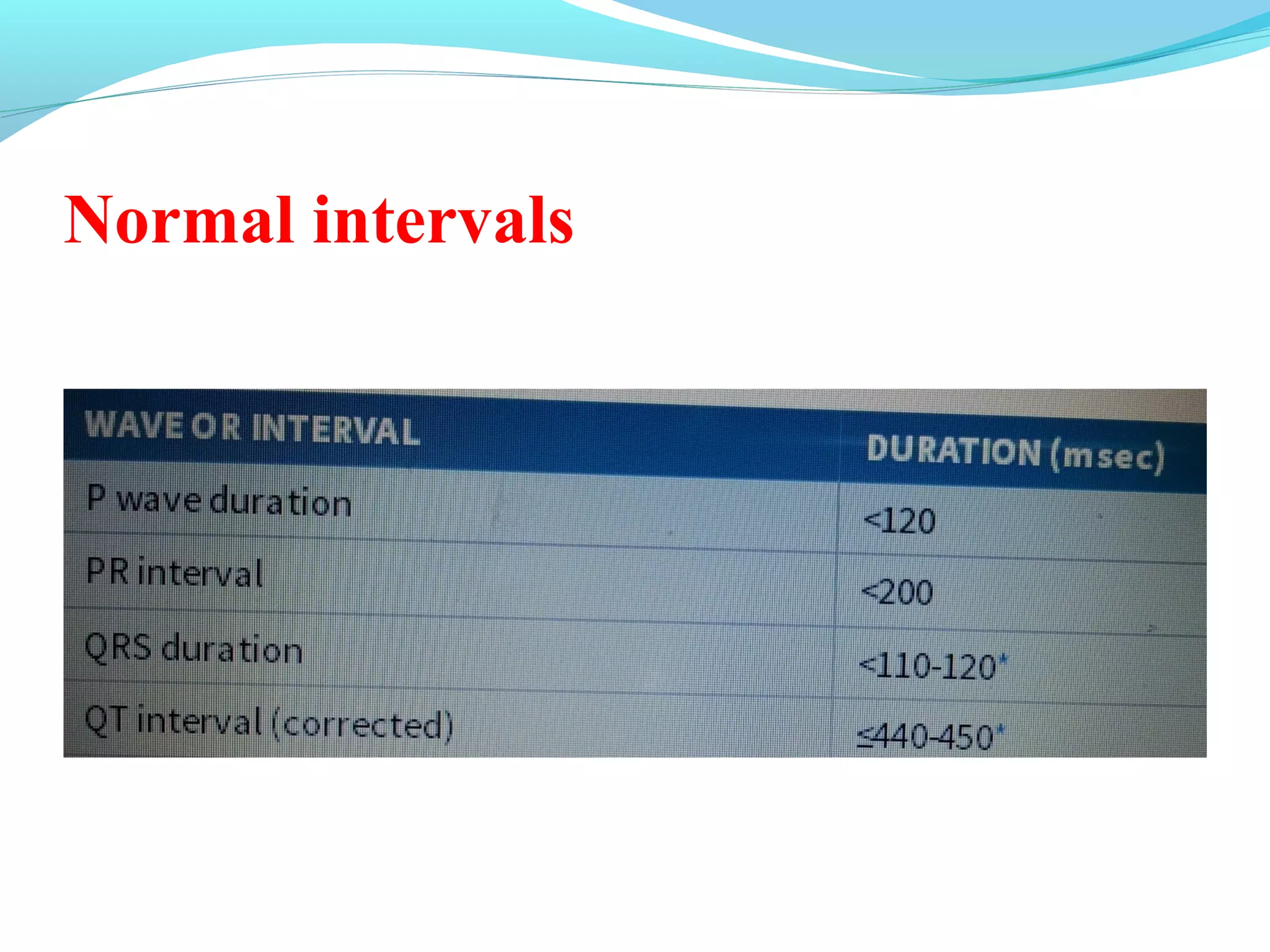 Basics of Electrocardiography(ECG) | PPT