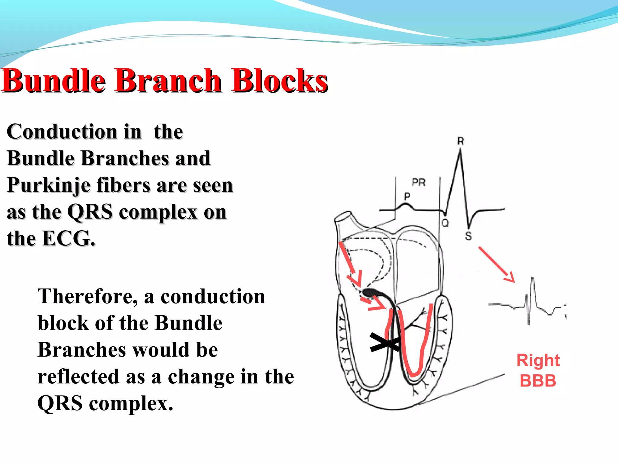 Basics of Electrocardiography(ECG) | PPT