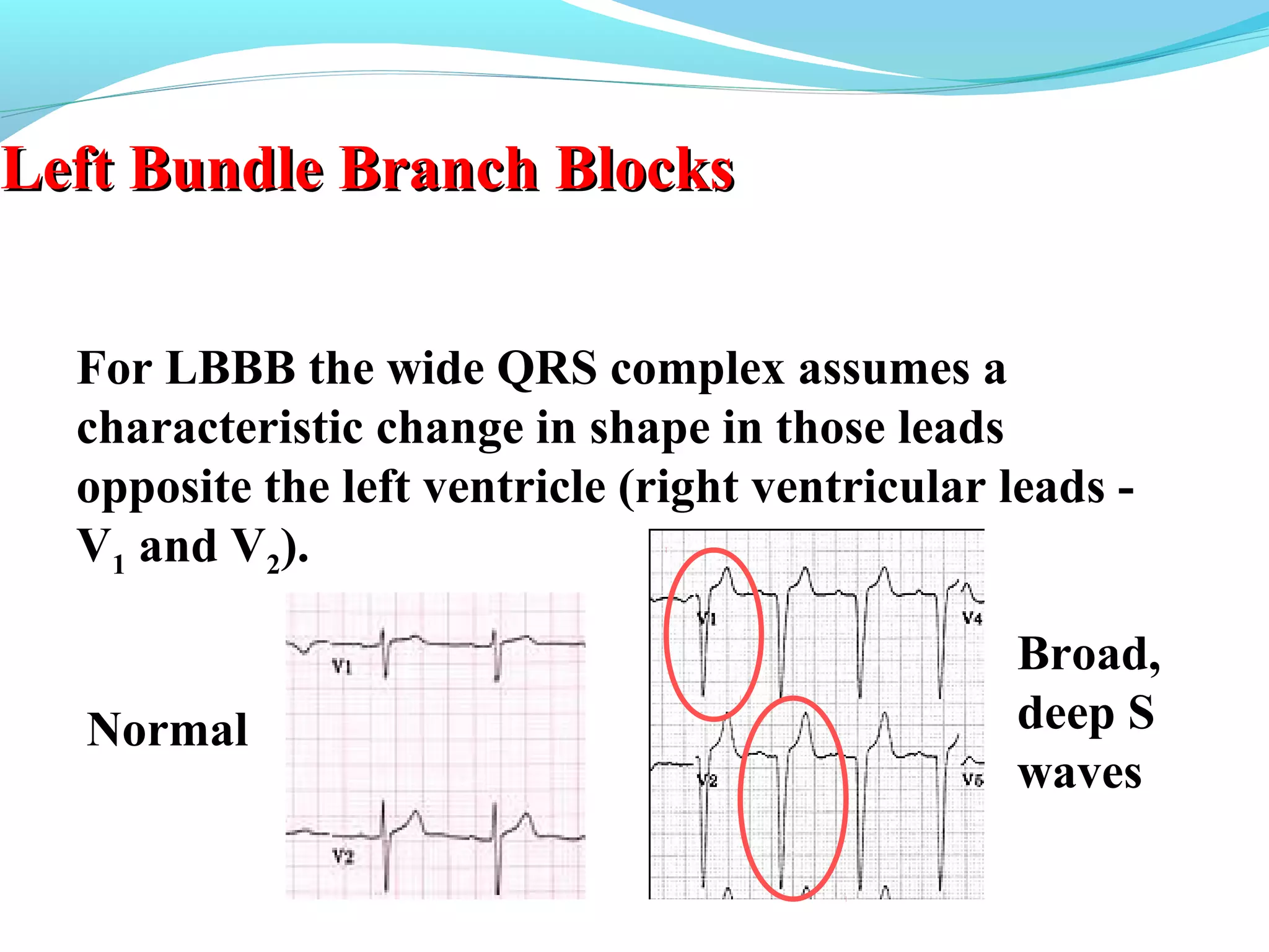 Basics of Electrocardiography(ECG) | PPT