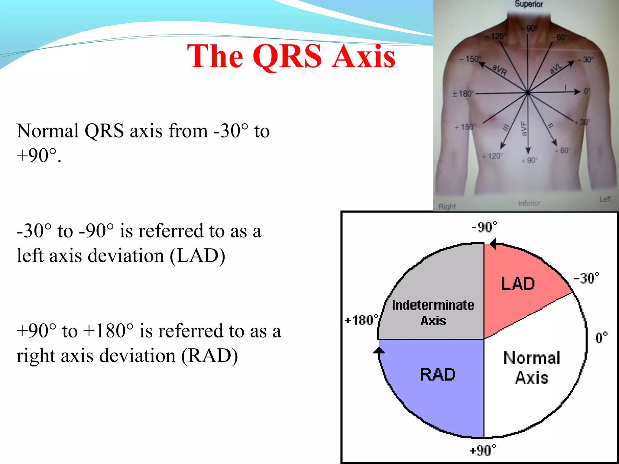 Basics of Electrocardiography(ECG) | PPT