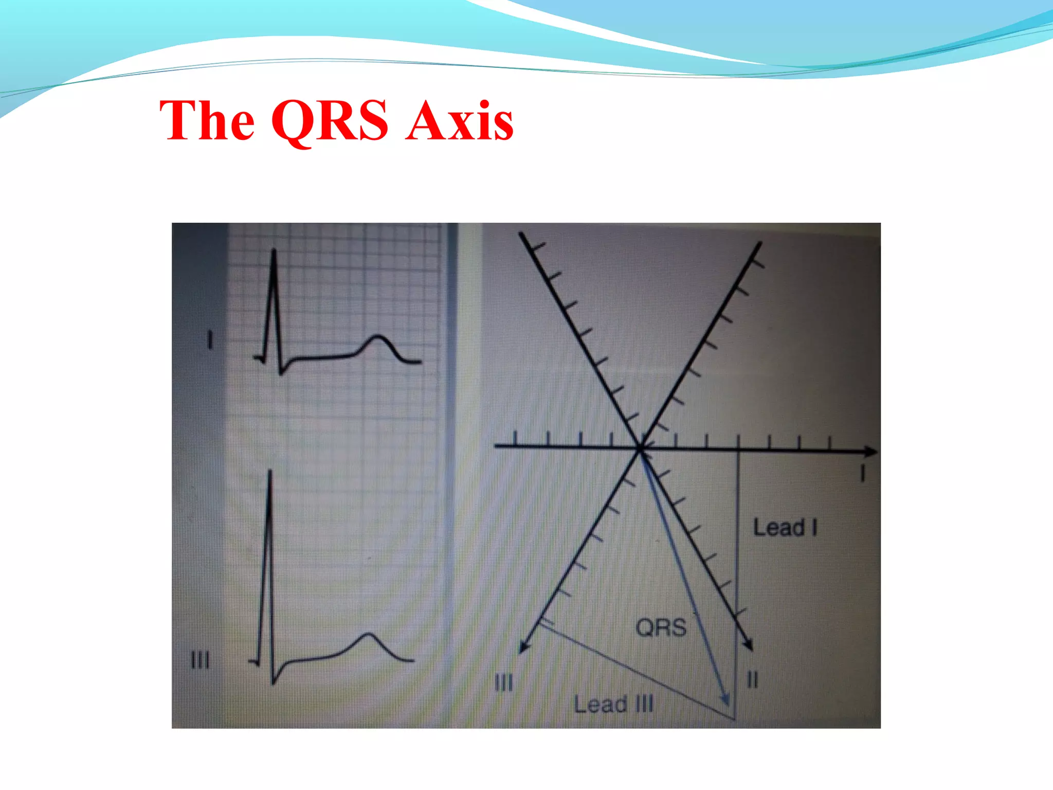 Basics of Electrocardiography(ECG) | PPT