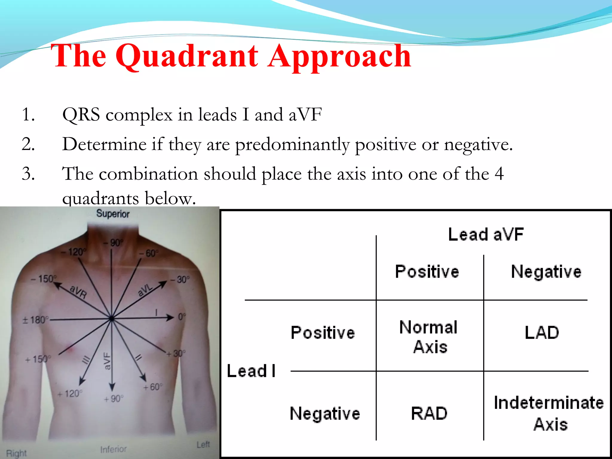 Basics of Electrocardiography(ECG) | PPT