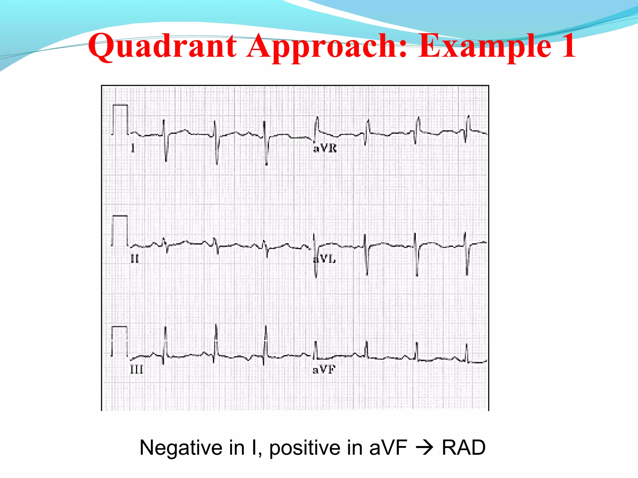 Basics of Electrocardiography(ECG) | PPT