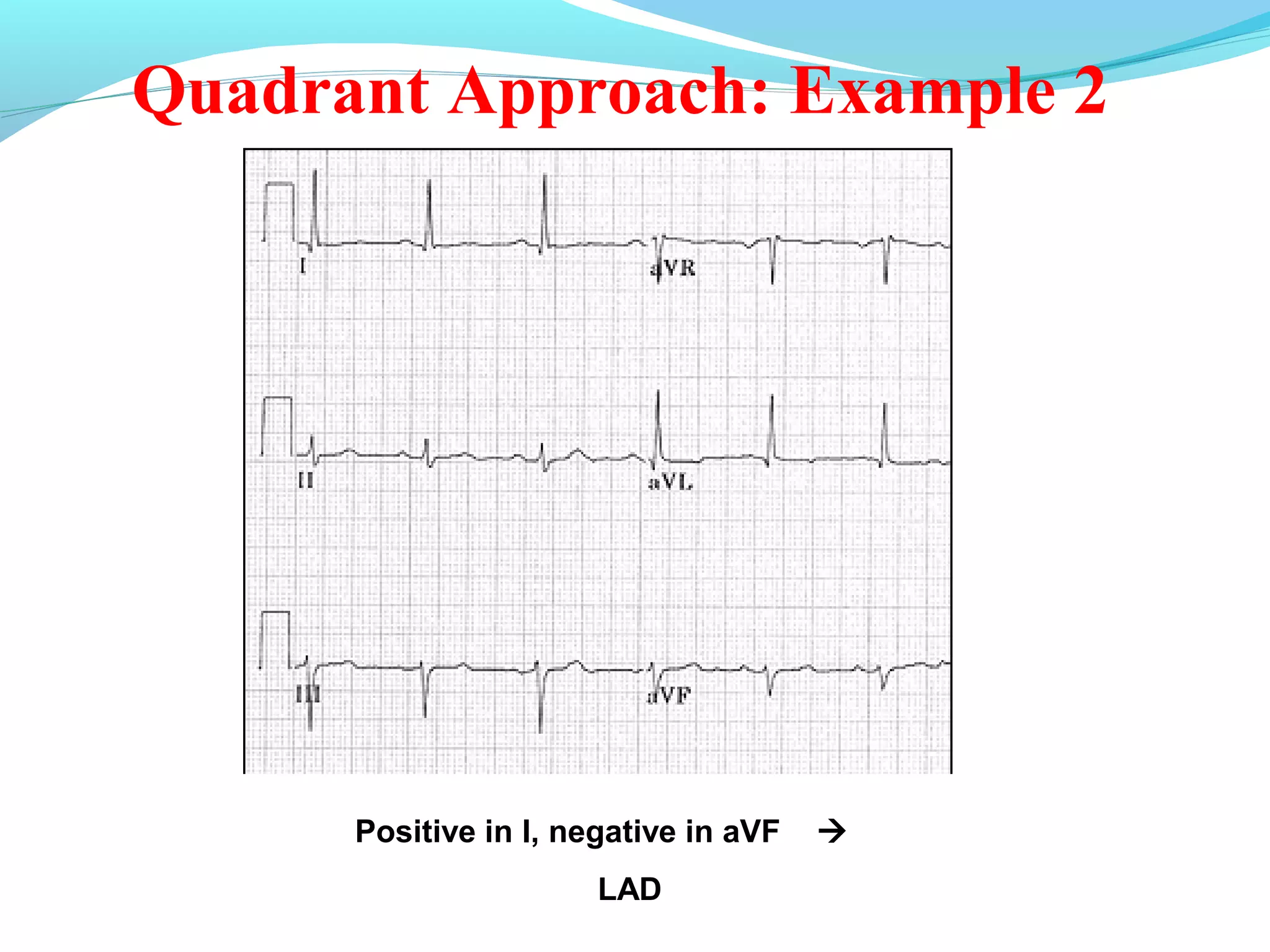 Basics of Electrocardiography(ECG) | PPT