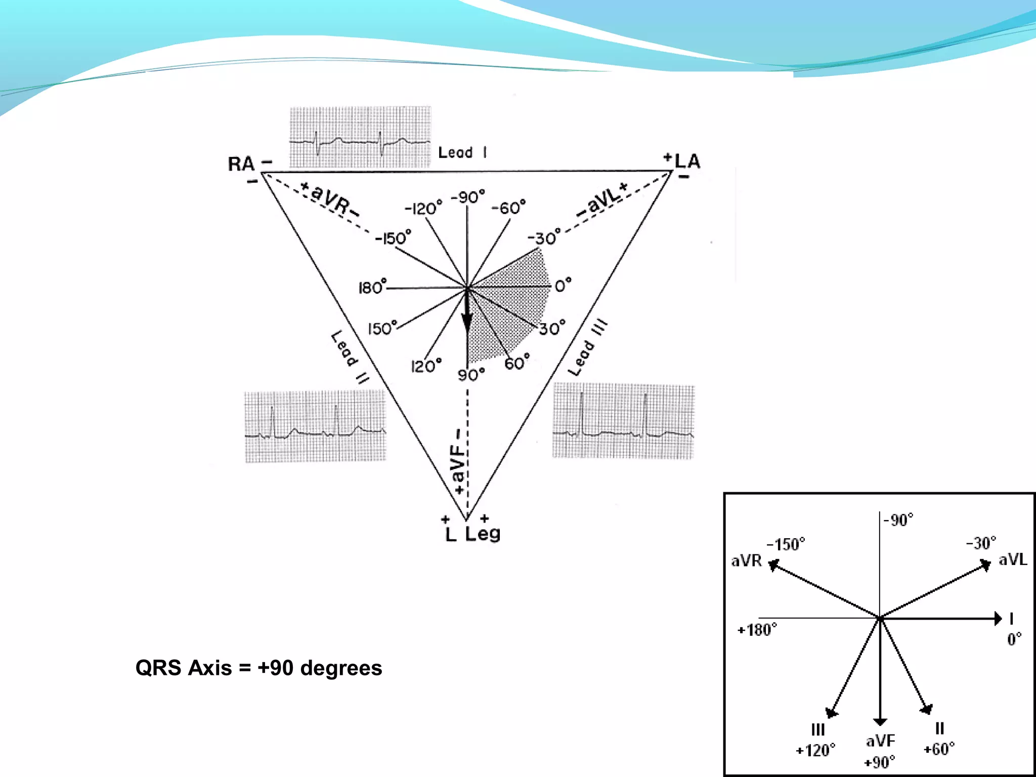 Basics of Electrocardiography(ECG) | PPT