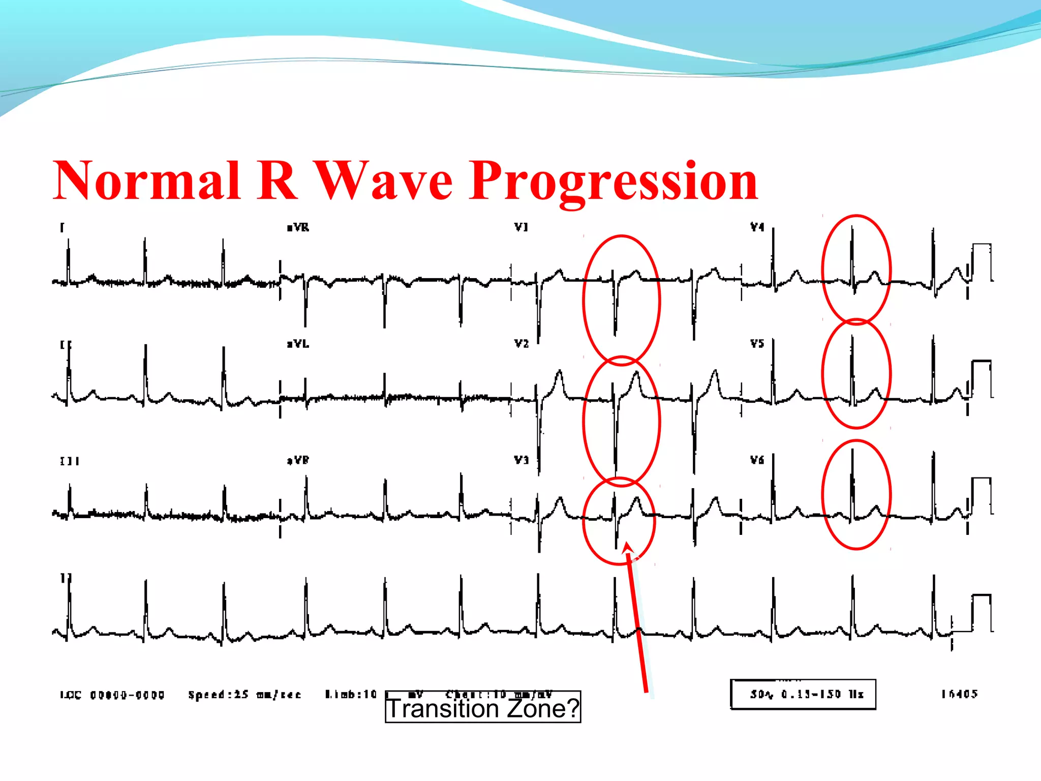 Basics of Electrocardiography(ECG) | PPT