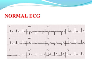 Basics of Electrocardiography(ECG) | PPT