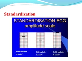 Basics of Electrocardiography(ECG) | PPT