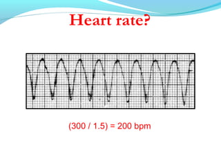 Basics of Electrocardiography(ECG) | PPT