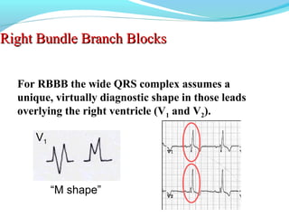 Basics of Electrocardiography(ECG) | PPT