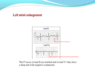 Basics of Electrocardiography(ECG) | PPT