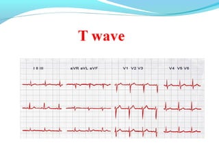 Basics of Electrocardiography(ECG) | PPT