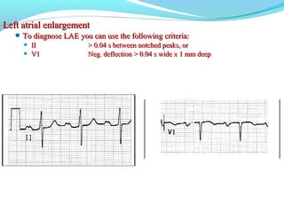 Basics of Electrocardiography(ECG) | PPT