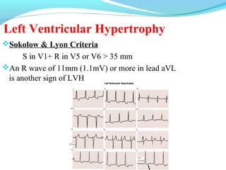 Basics of Electrocardiography(ECG) | PPT