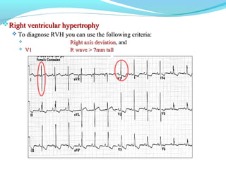 Basics of Electrocardiography(ECG) | PPT