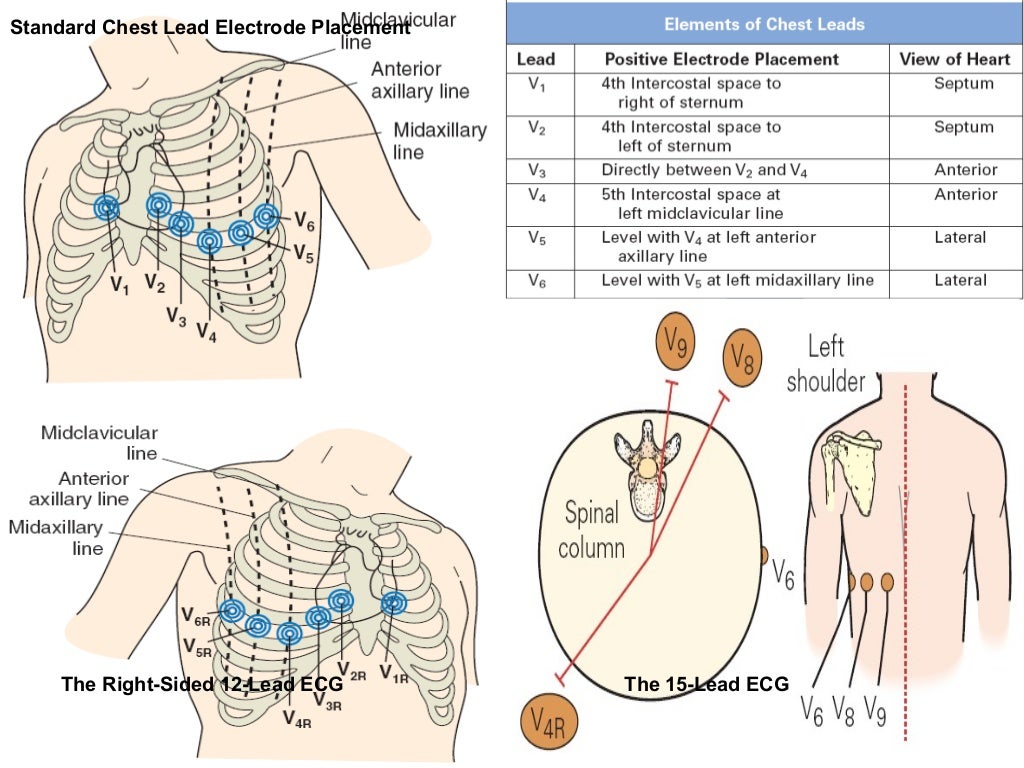 Basics of Electrocardiography(ECG)