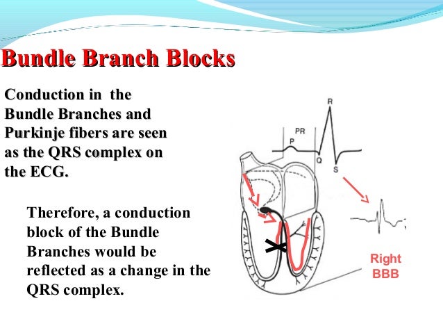 Basics of Electrocardiography(ECG)