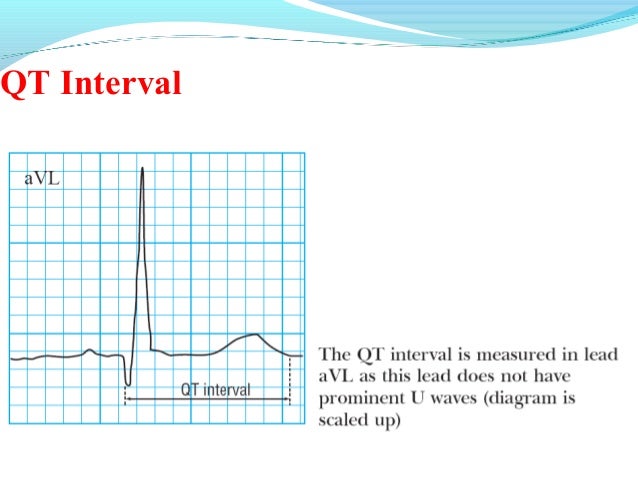 Basics of Electrocardiography(ECG)