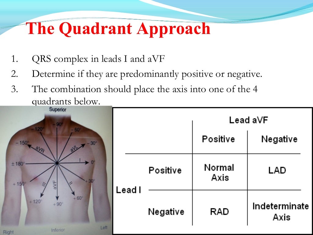 Basics of Electrocardiography(ECG)