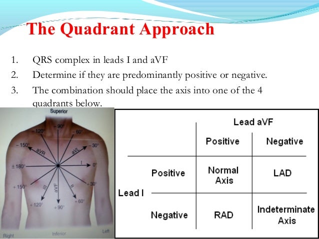 Basics of Electrocardiography(ECG)