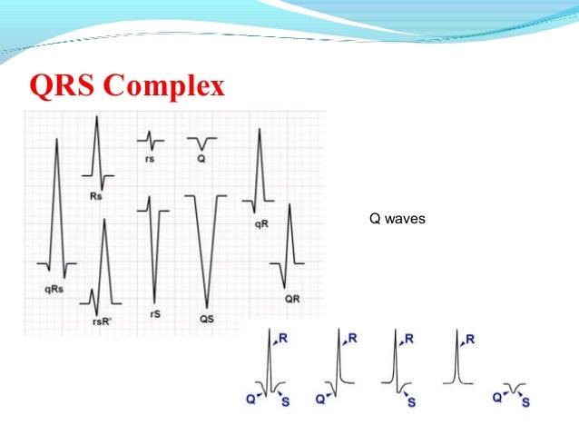 Basics of Electrocardiography(ECG)