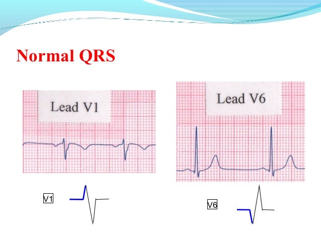 Basics of Electrocardiography(ECG)