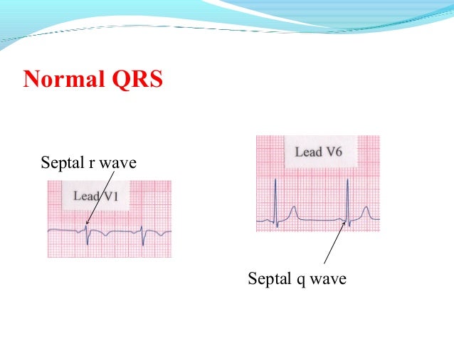 Basics of Electrocardiography(ECG)