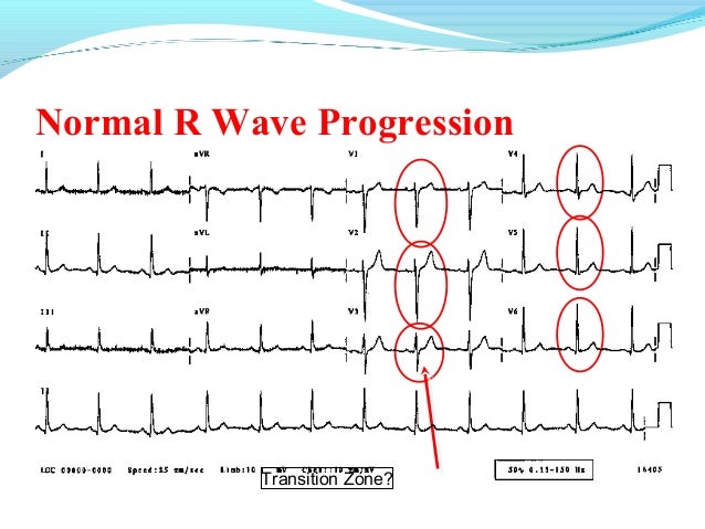 Basics of Electrocardiography(ECG)