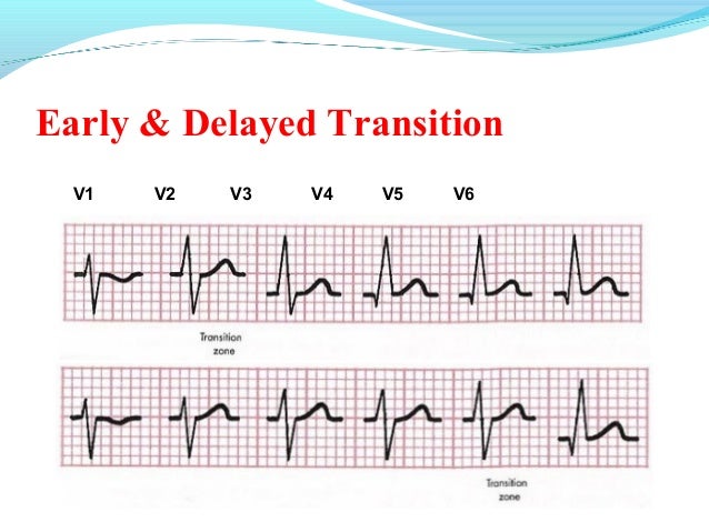 Basics of Electrocardiography(ECG)