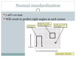 Basics of ecg | PPT