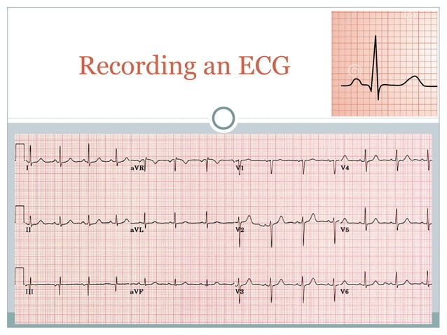 Basics of ecg