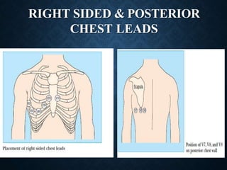 Basics of ecg | PPTX