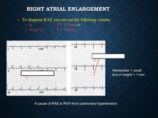 Basics of ecg | PPTX