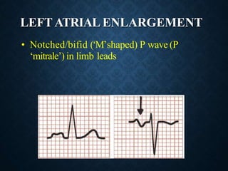 Basics of ecg | PPTX