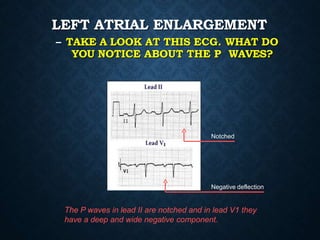 Basics of ecg | PPTX