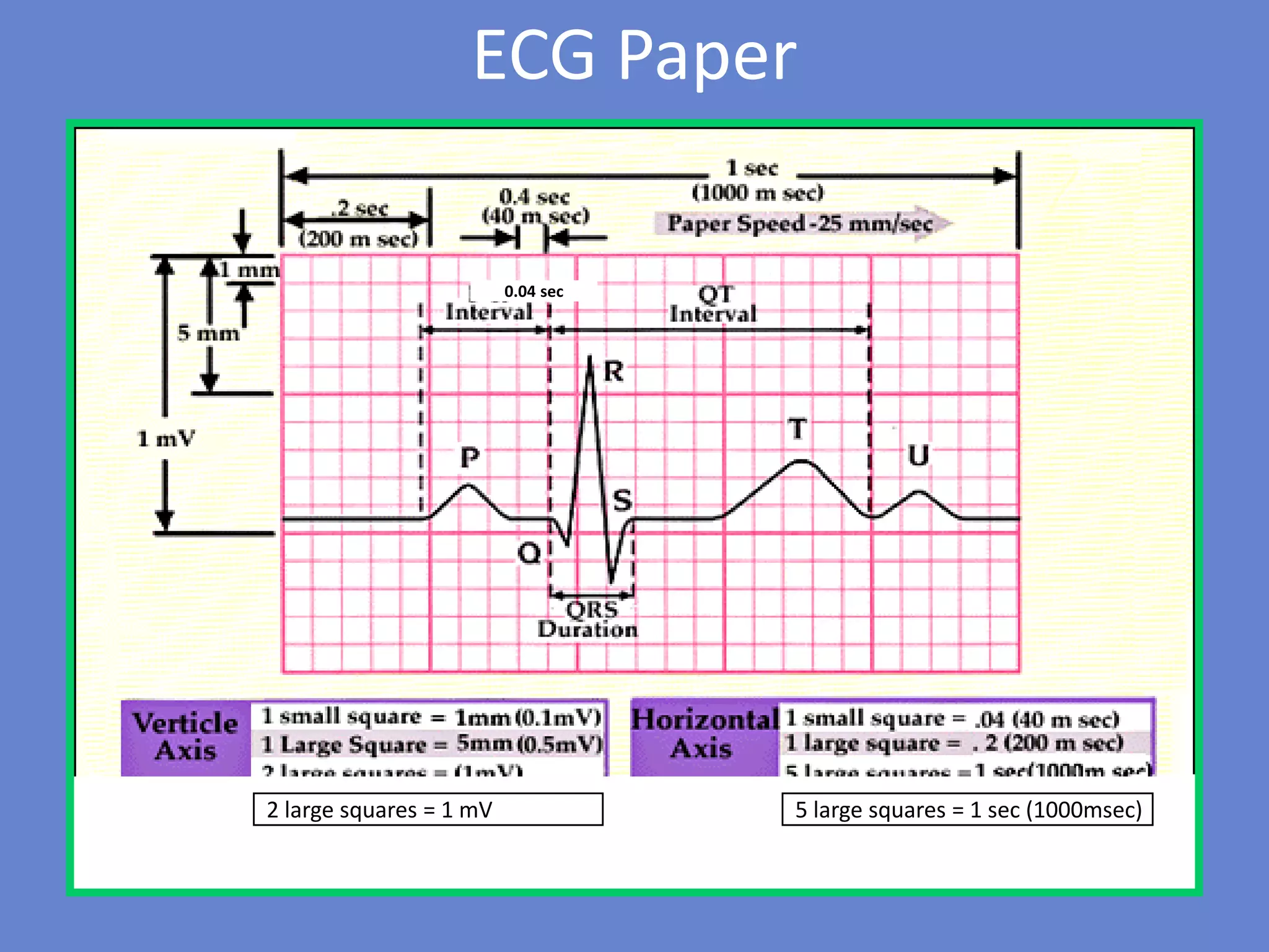 Basics of ecg | PDF