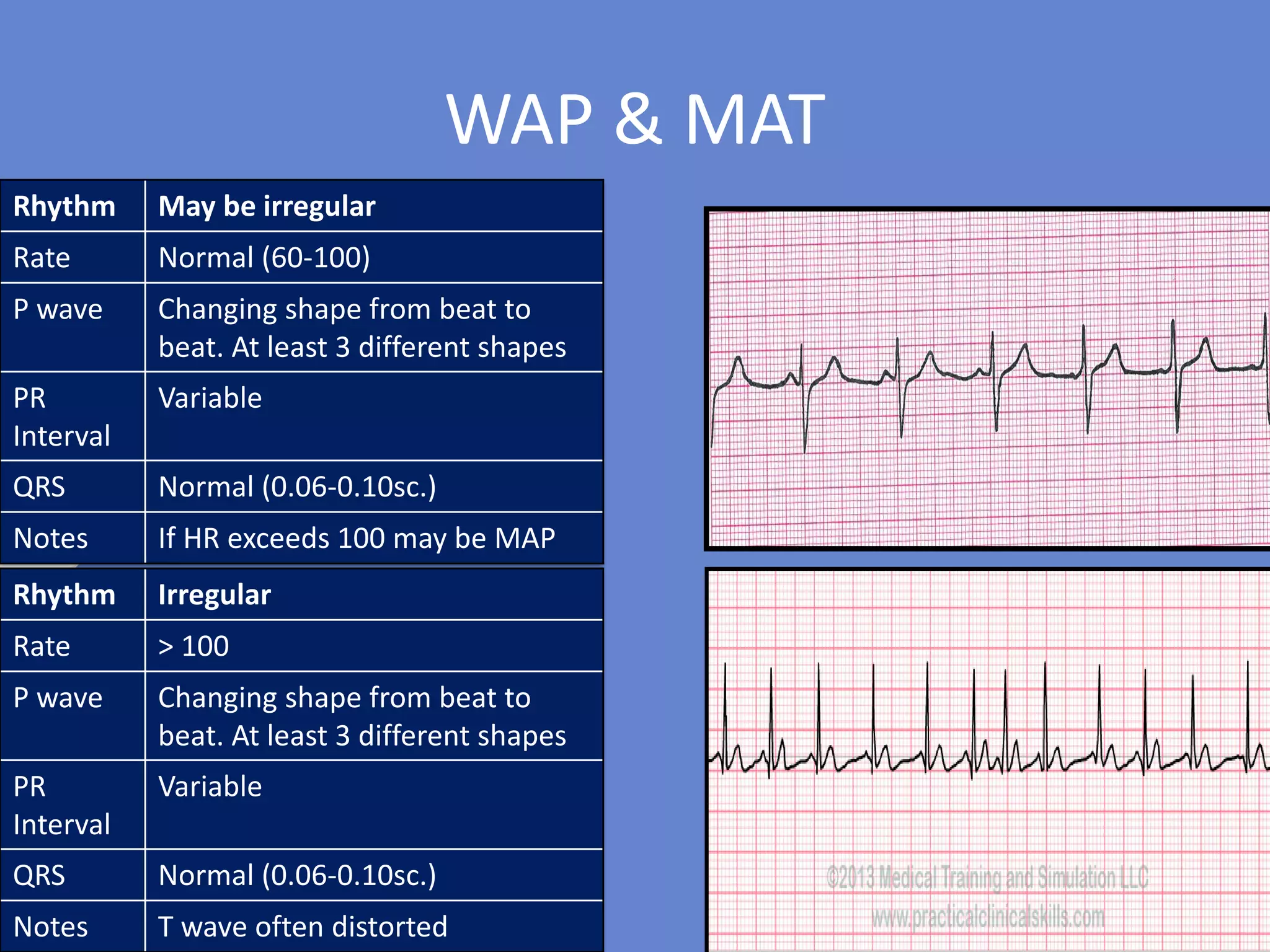 Basics of ecg | PDF