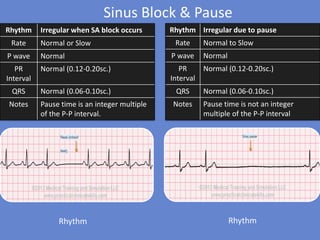 Basics of ecg | PDF