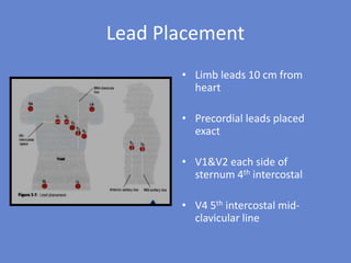 Basics of ecg | PDF