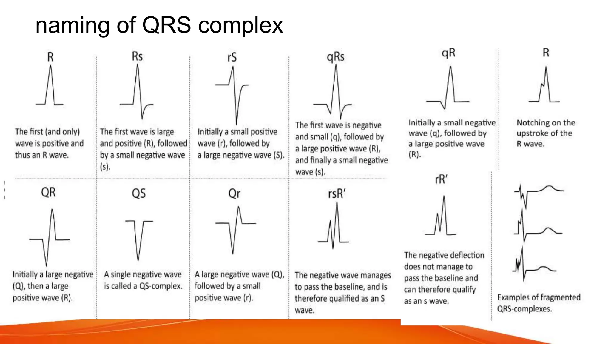 Basics of ecg | PPTX | Heart and Cardiovascular Diseases | Diseases and ...