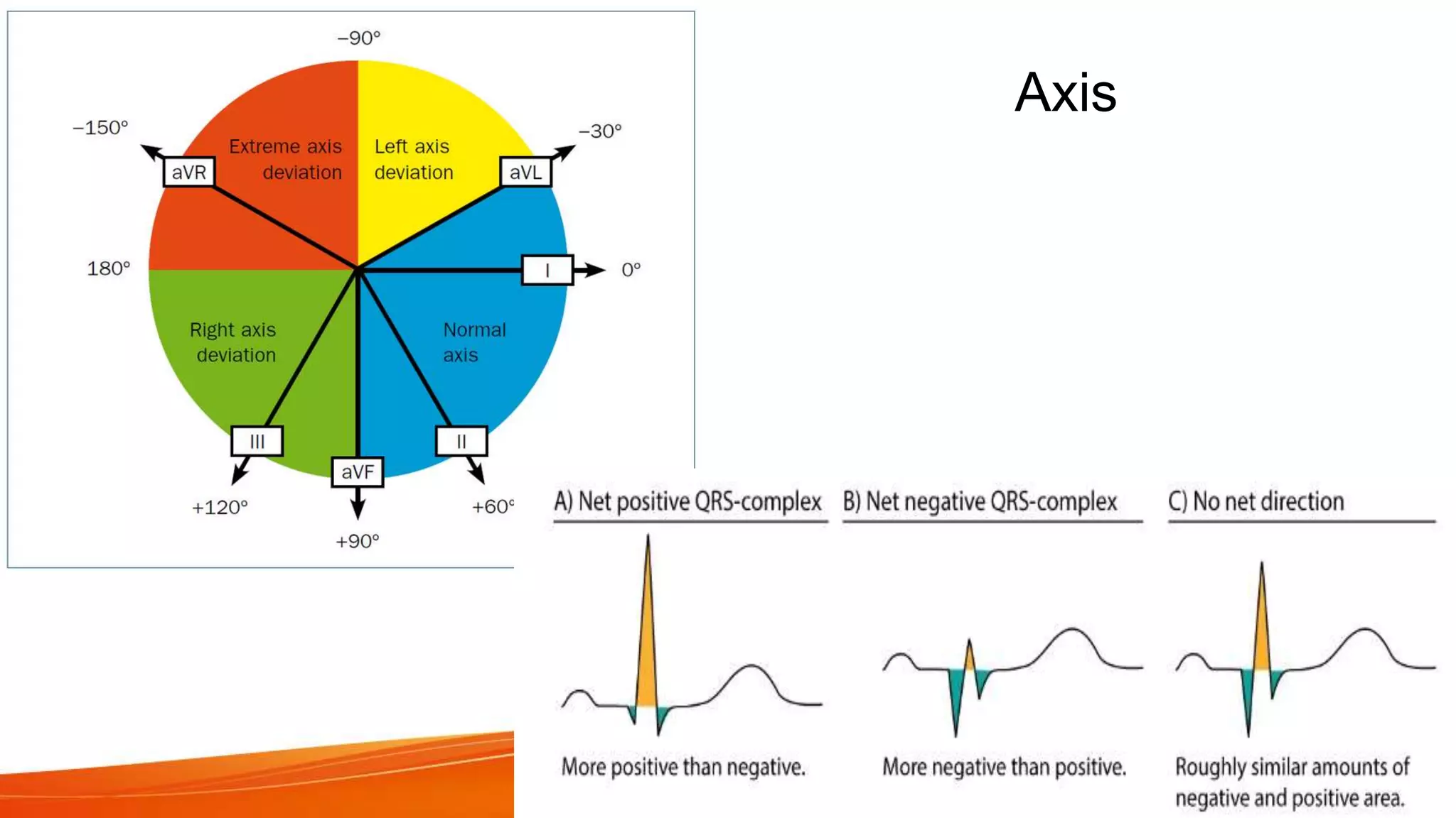 Basics of ecg | PPTX | Heart and Cardiovascular Diseases | Diseases and ...