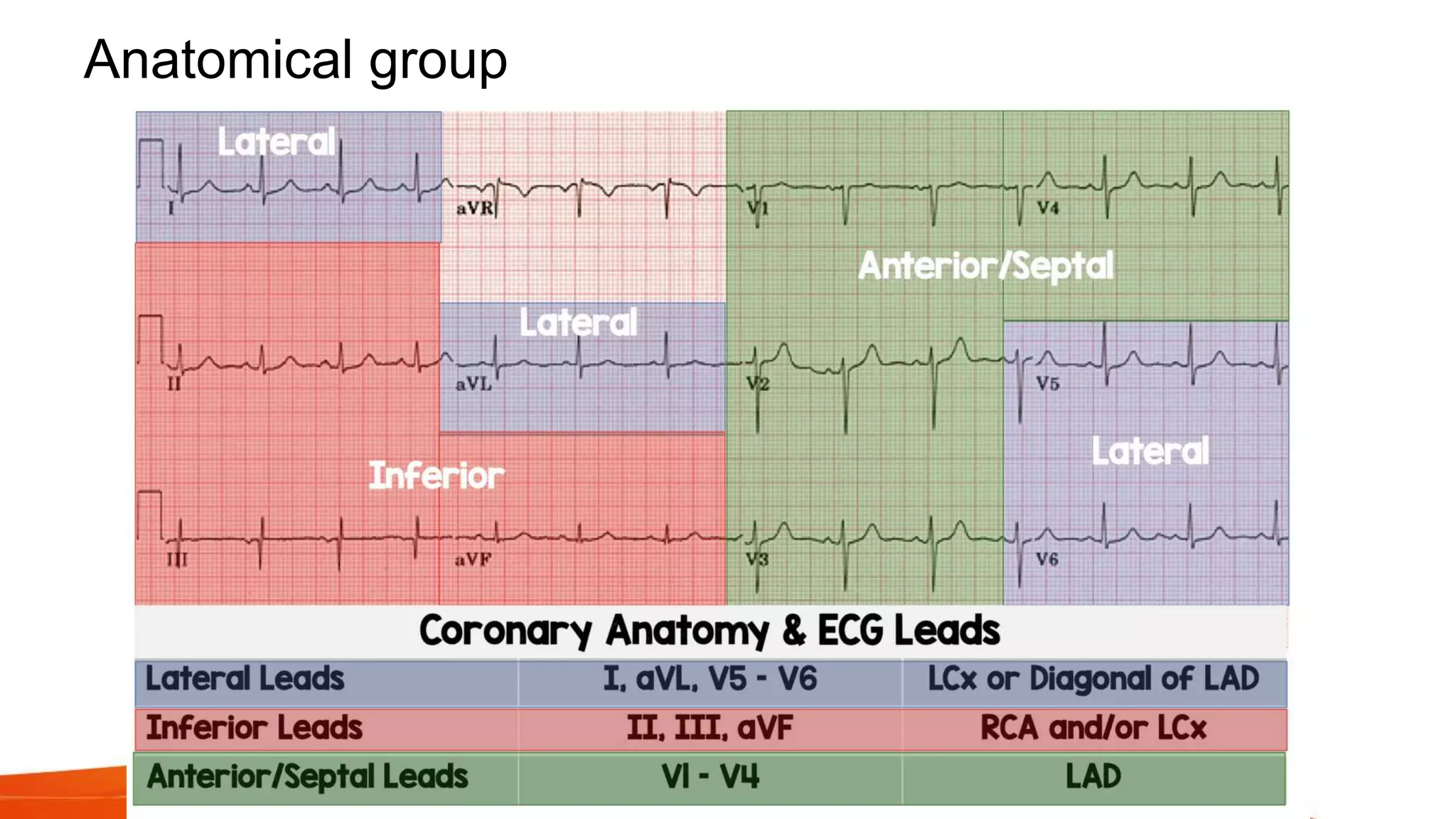 Basics of ecg | PPTX | Heart and Cardiovascular Diseases | Diseases and ...