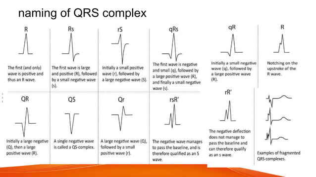 Basics of ecg | PPTX | Heart and Cardiovascular Diseases | Diseases and ...