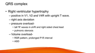Basics of ecg | PPTX