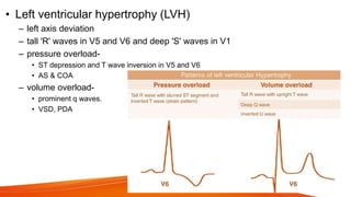 Basics of ecg | PPTX
