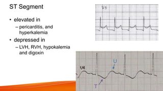 Basics of ecg | PPTX