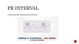 Basics of ECG.pptx
