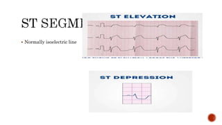 Basics of ECG.pptx