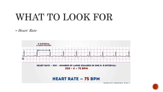Basics of ECG.pptx