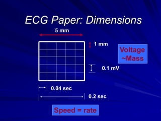 Basics of ECG.ppt